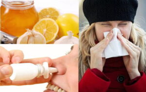 Rinitis causas y remedios naturales para combatirla - Buena Salud